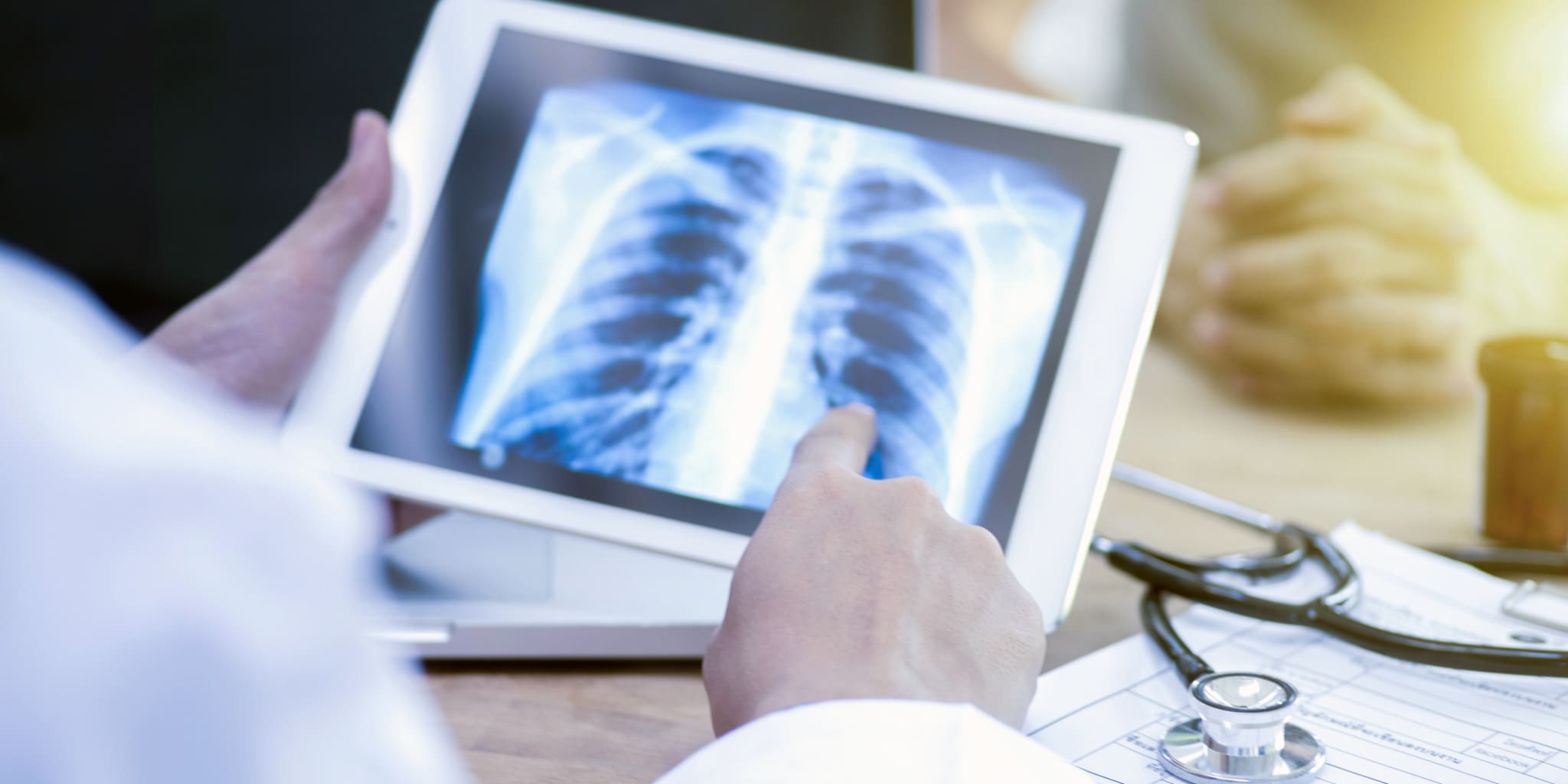 Tuberkulose: Behandlung ist nun kürzer und leichter verträglich - coliquio