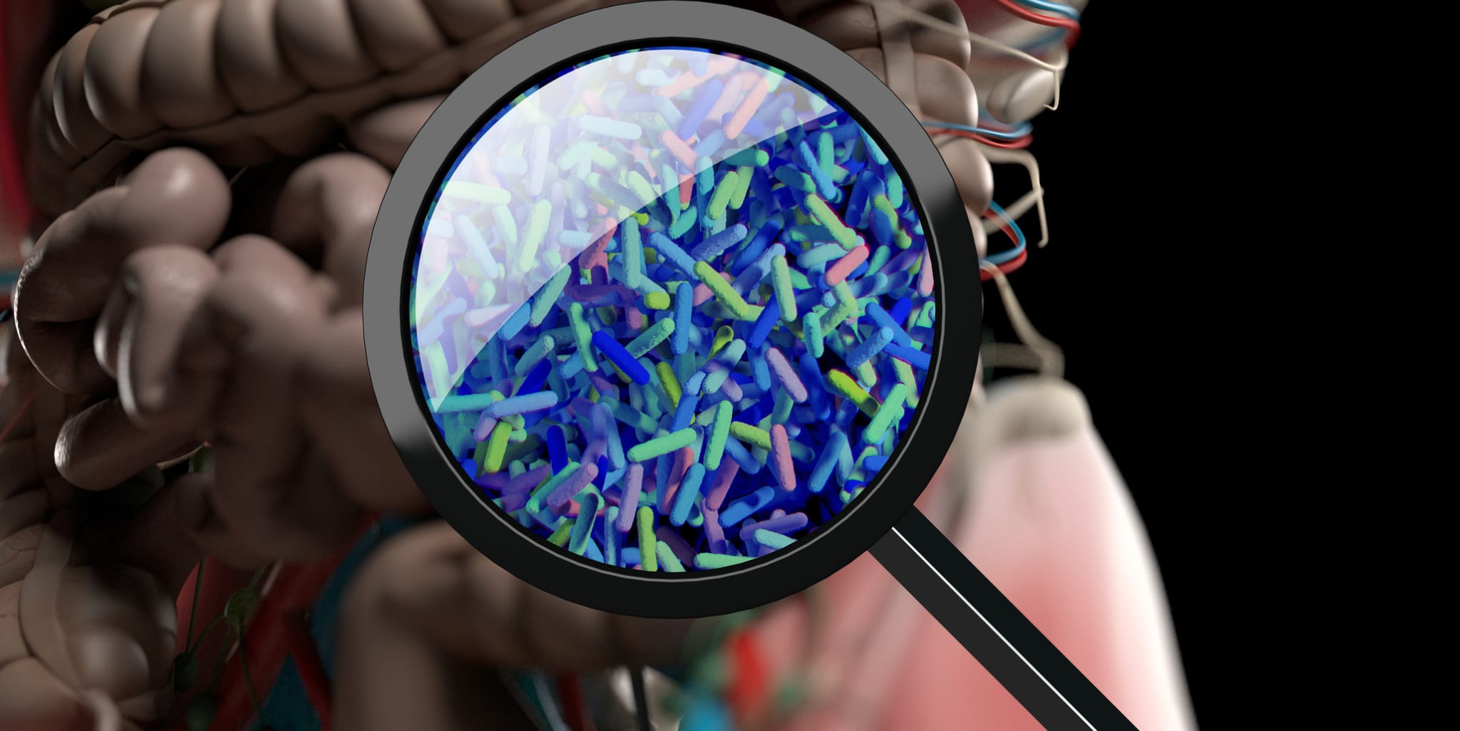 Darmbakterien verschlimmern Bauchverwachsungen nach Operationen - coliquio