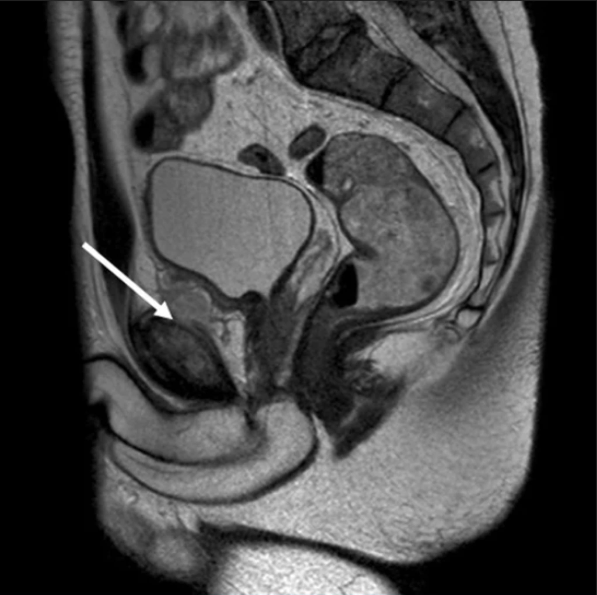Teil 2: Fußballer (28) mit Bauchschmerzen, Durchfall und ...