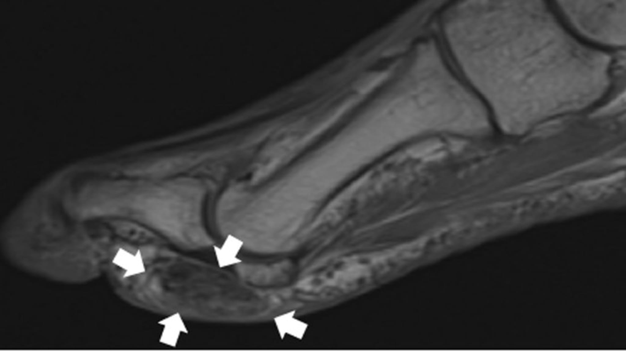Bildgebung führt zur Lösung