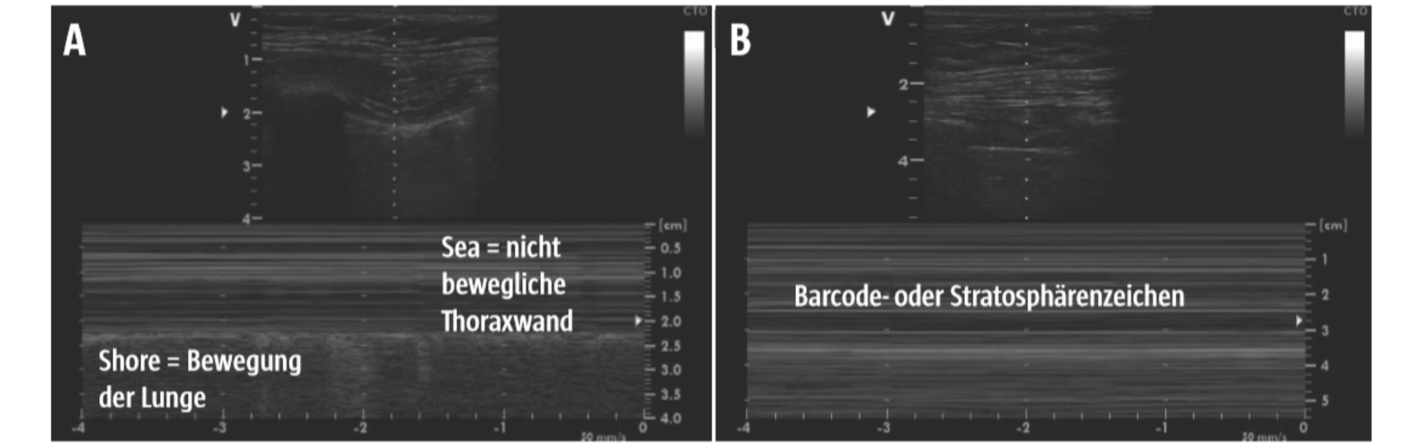 Fokussierter Ultraschall in der Intensivmedizin - coliquio