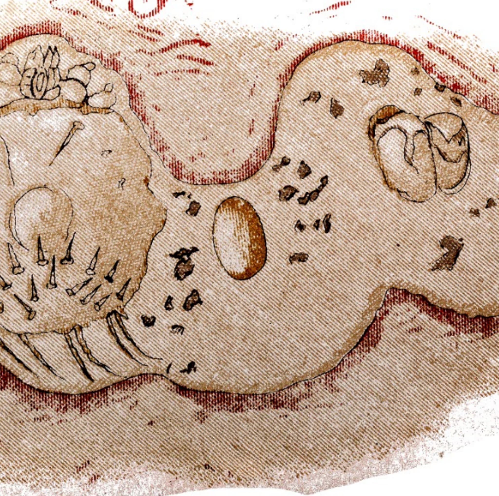 Krätze auf dem Vormarsch – Wissenswertes im Überblick - coliquio