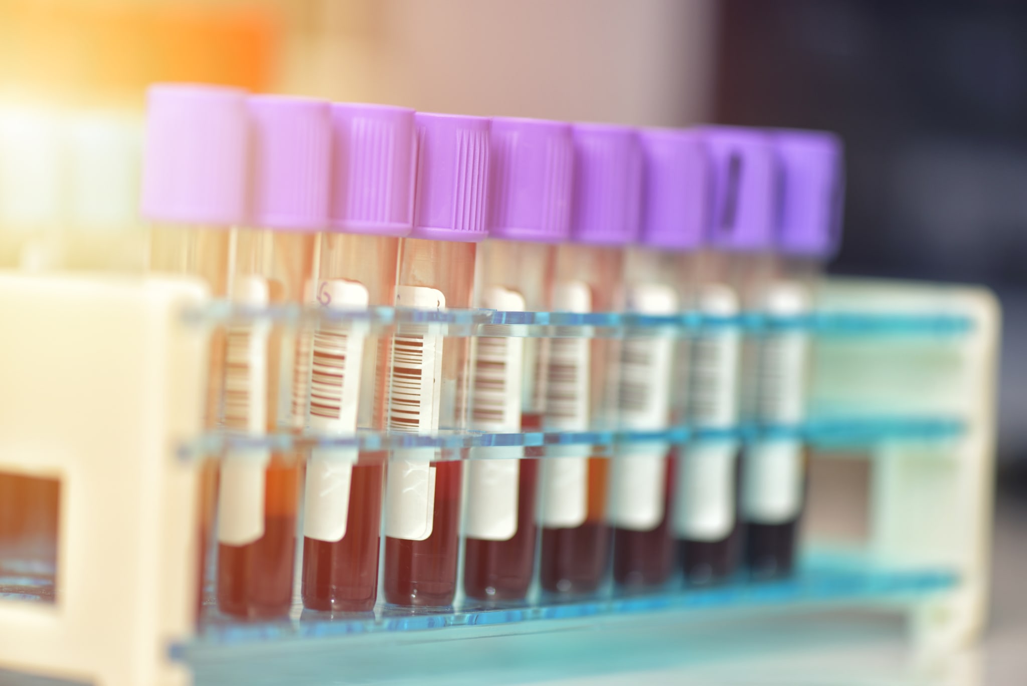 Die wichtigsten Laborwerte im Blick