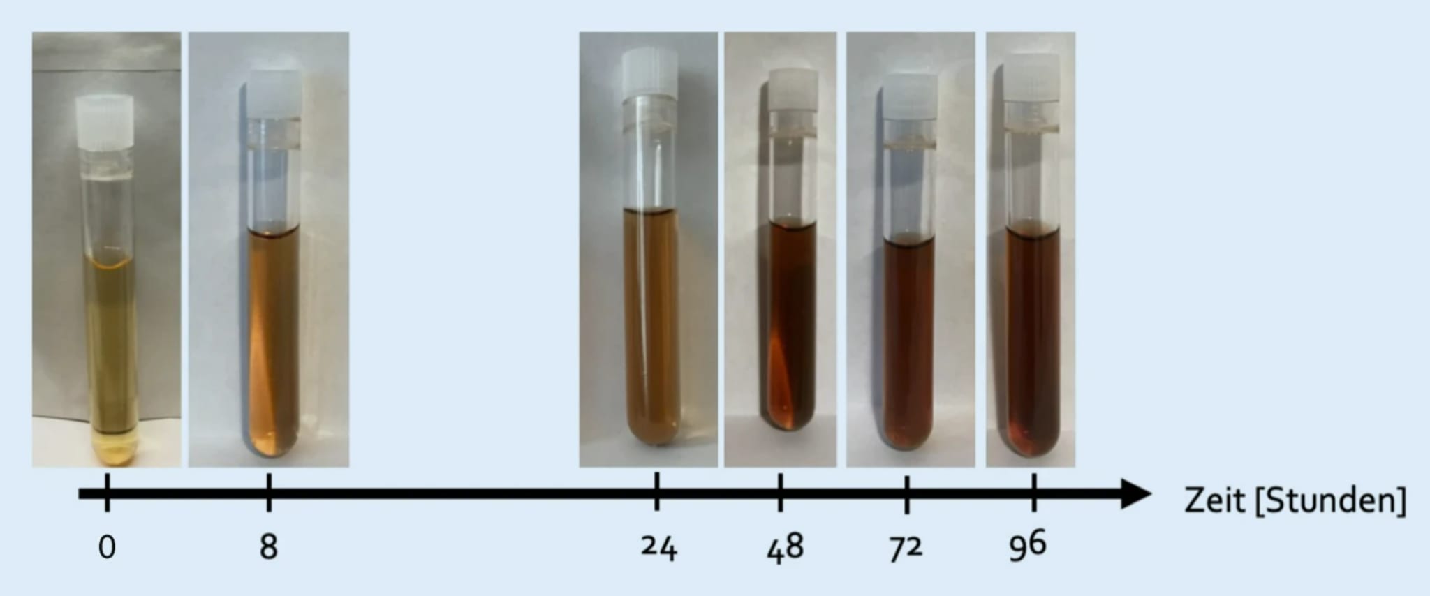 Blutiger Urin: Diagnose einer seltenen Stoffwechselerkrankung - coliquio