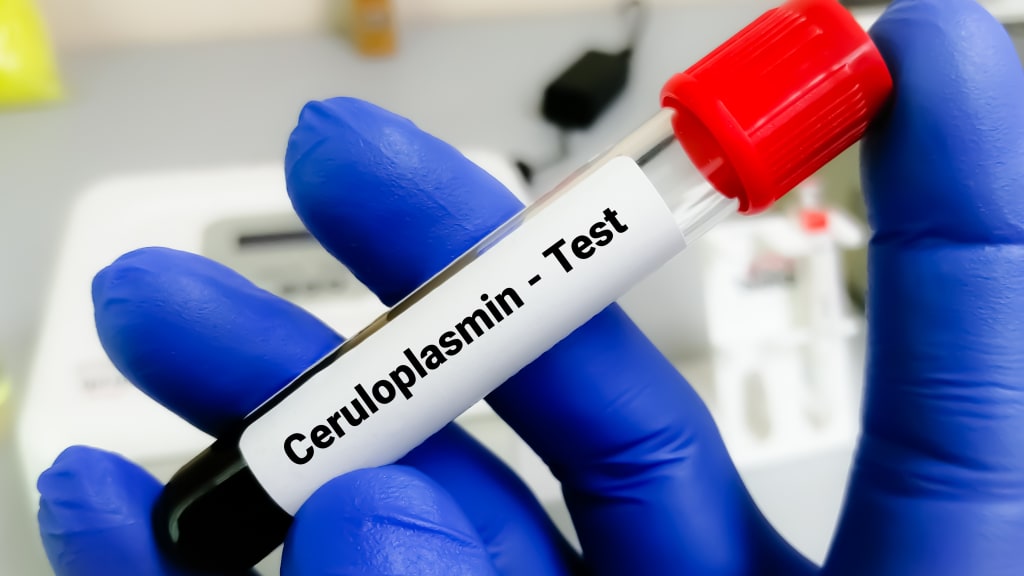 S1-Leitlinie Morbus Wilson