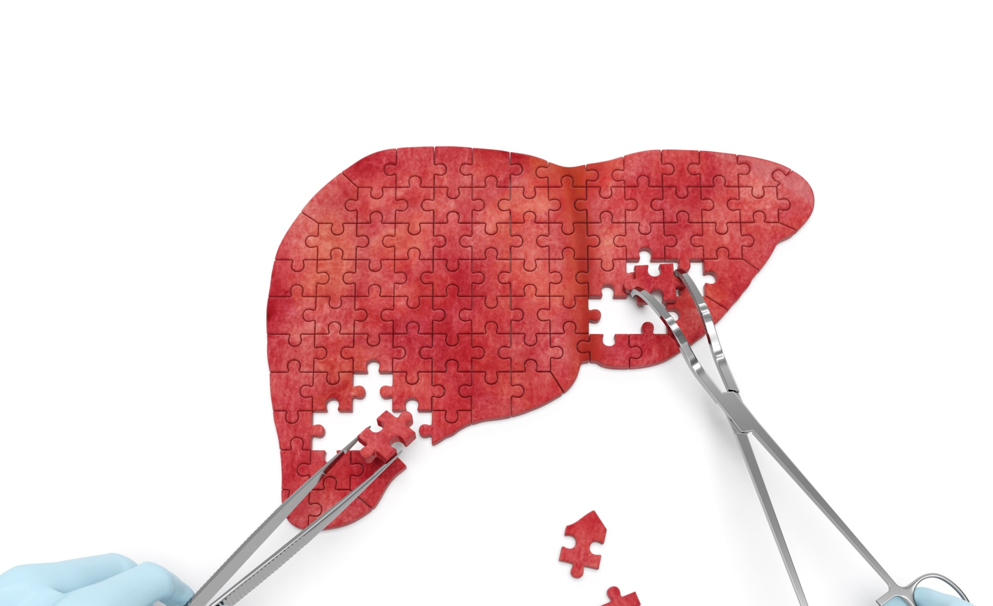 Erhöhte Leberwerte: Übersicht für eine schnelle Diagnostik ...