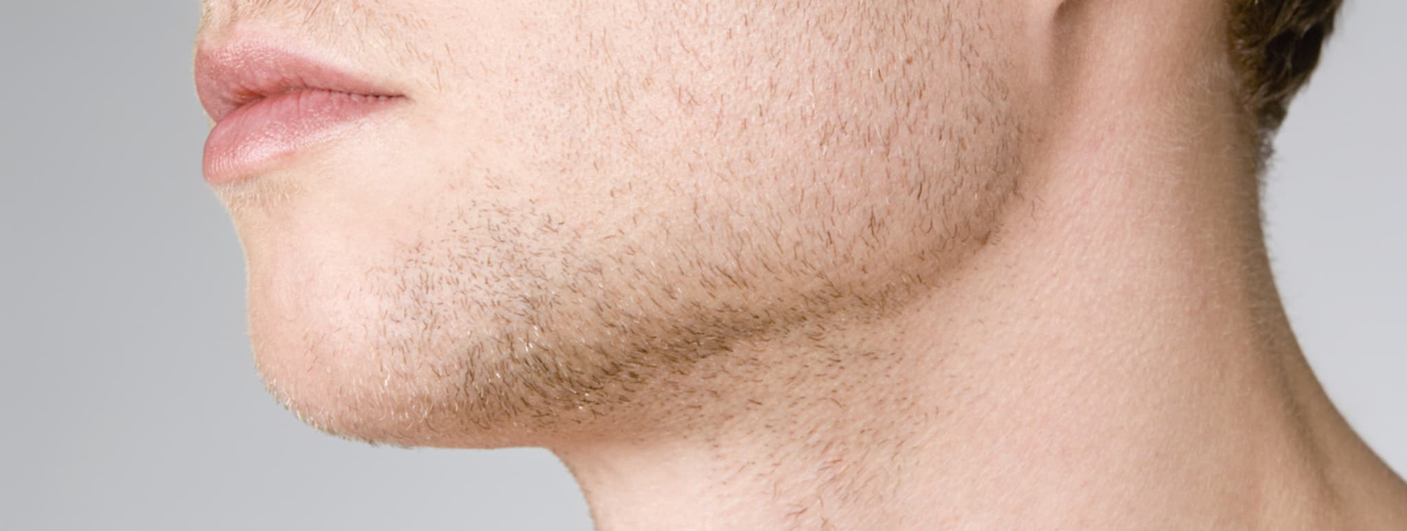 Numb-Chin-Syndrom: Zwei Fallberichte - coliquio