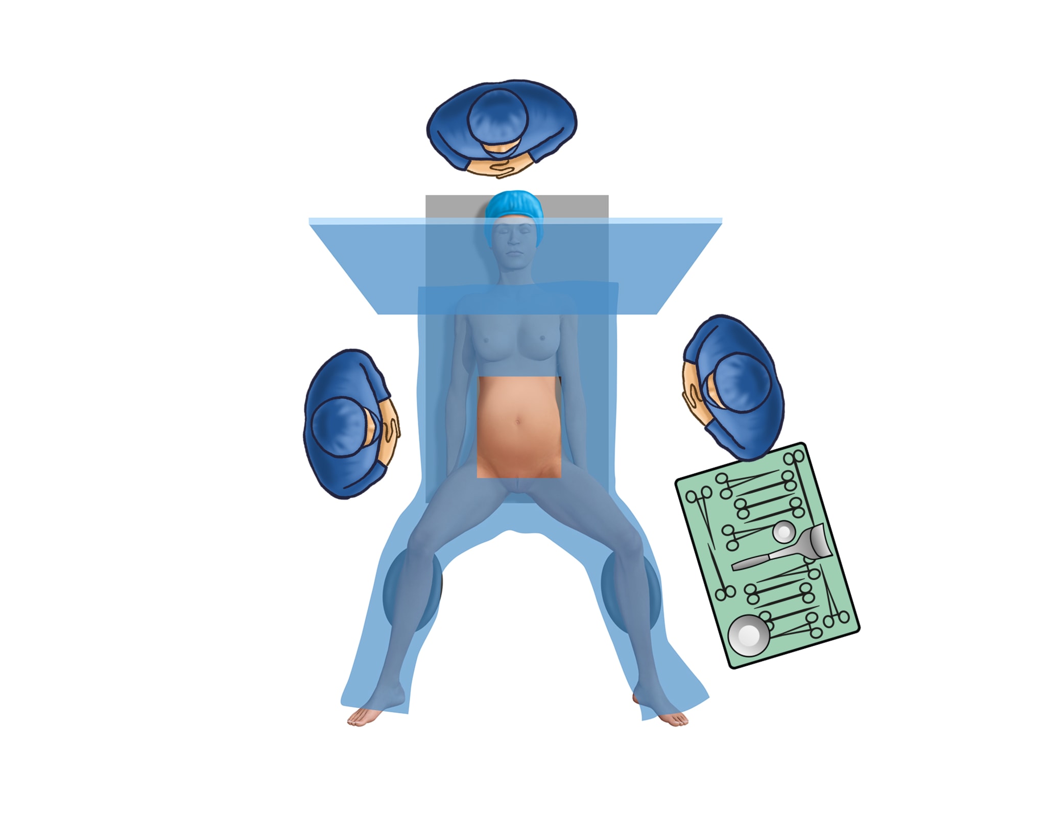 Lehrvideo: Sectio caesarea