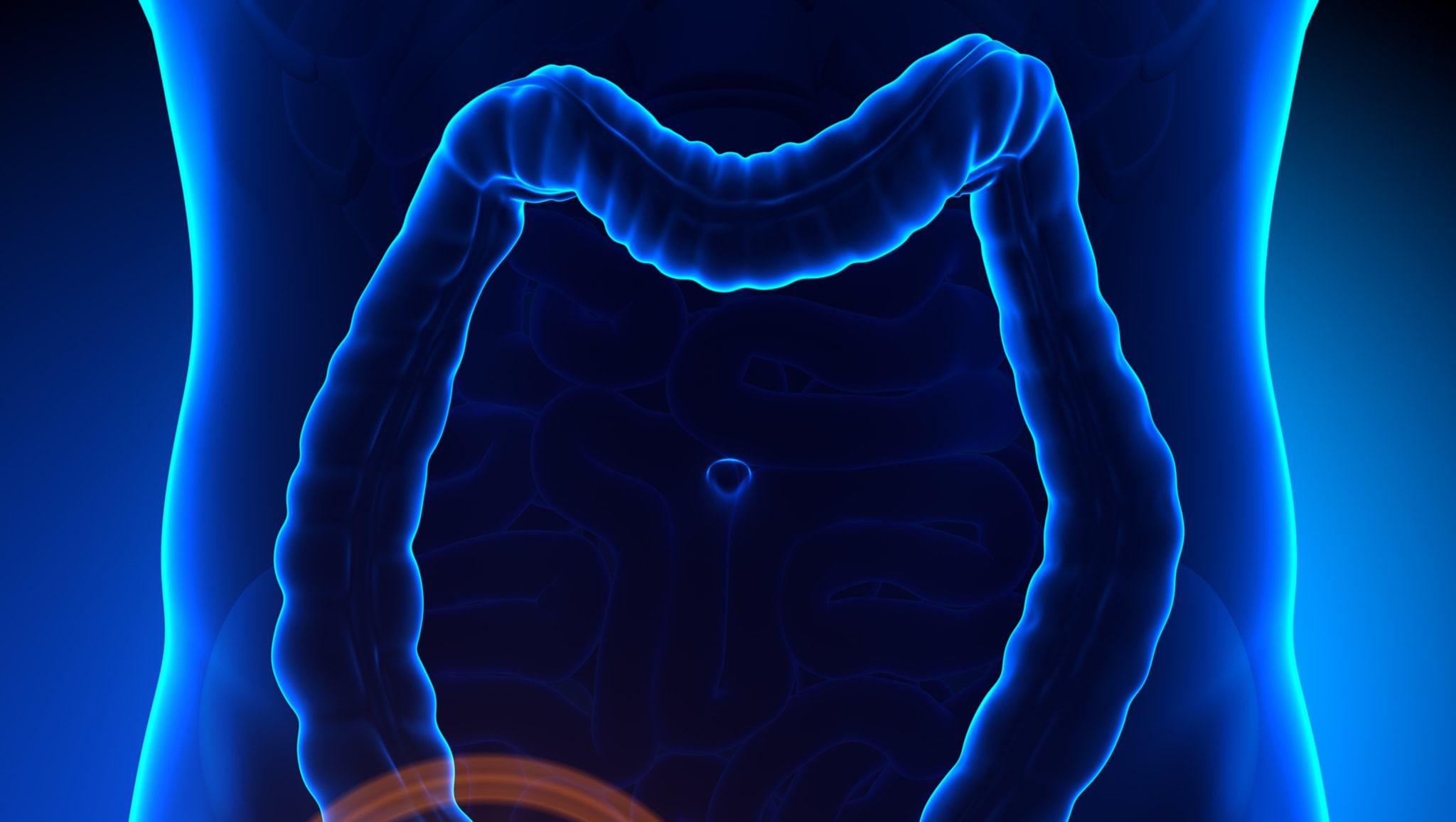 Neue S1-Leitlinie zur Therapie der akuten Appendizitis bei Erwachsenen ...