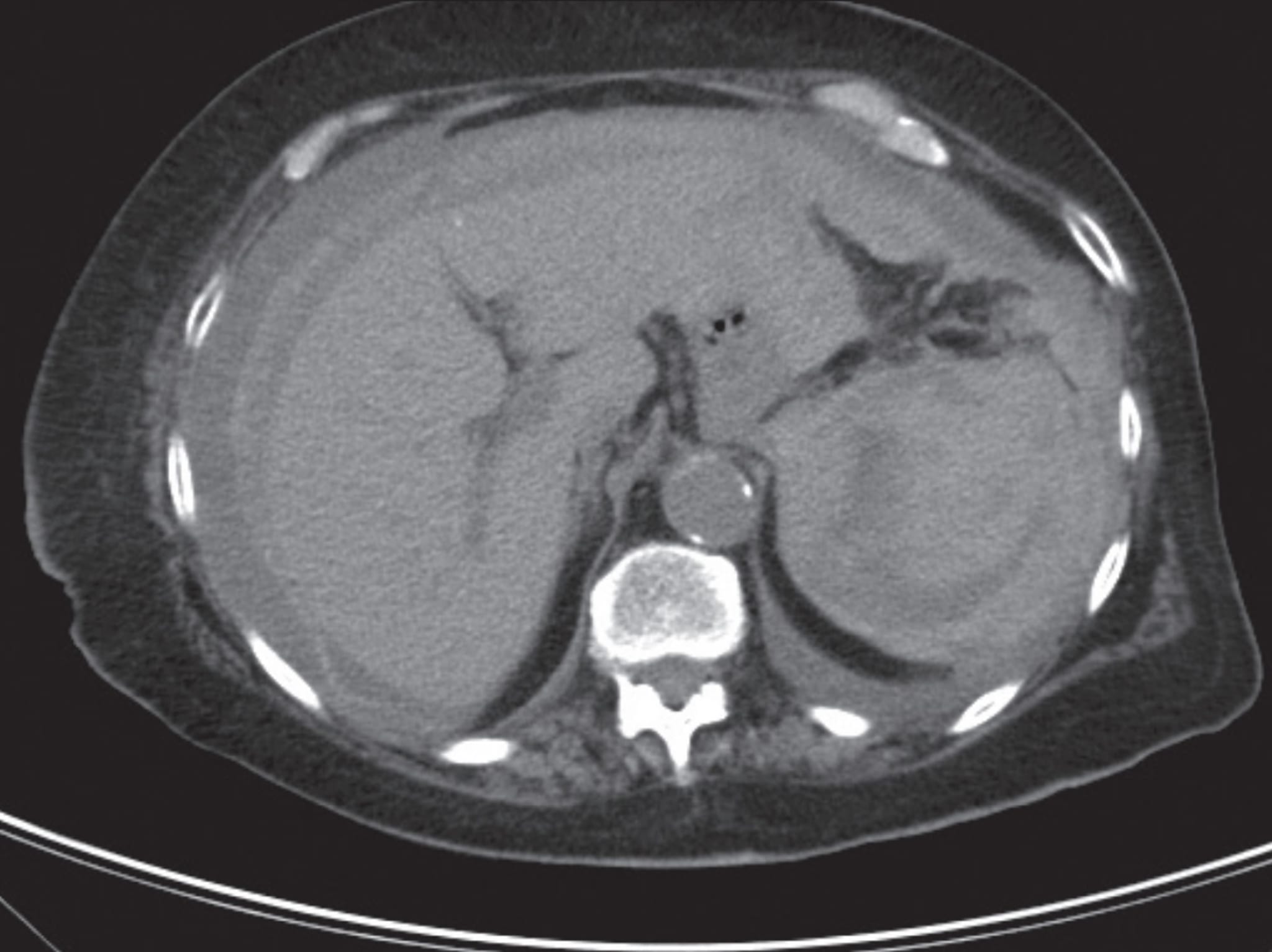 Das steckt hinter der Anämie
