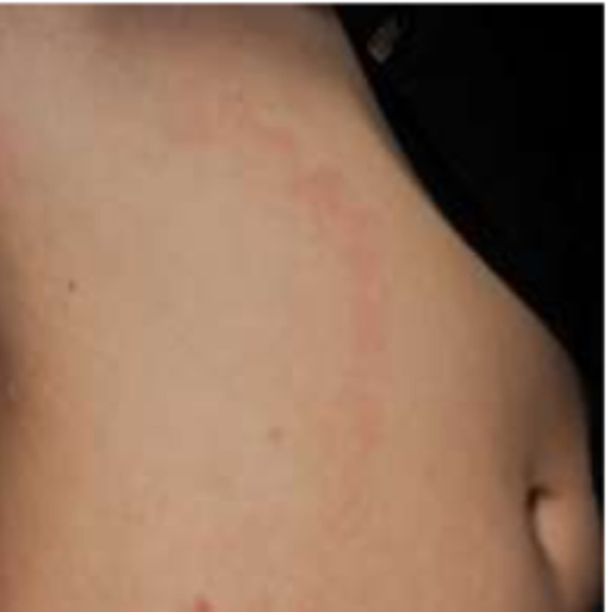 Stillen Bei Borreliose? : Neuroborreliose: Symptome erkennen und ...