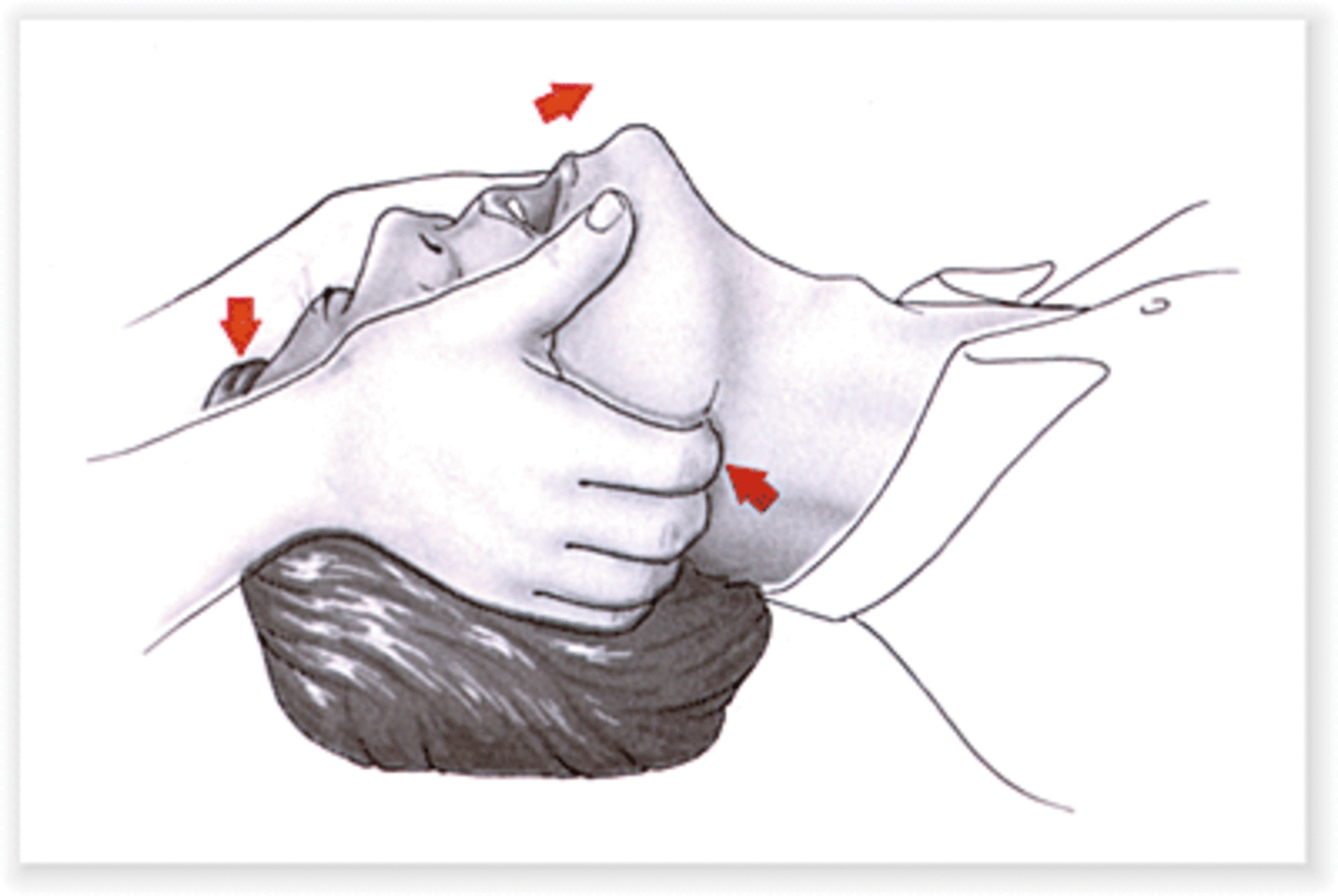 Der Ertrinkungsunfall – wichtige Schritte der ersten Hilfe