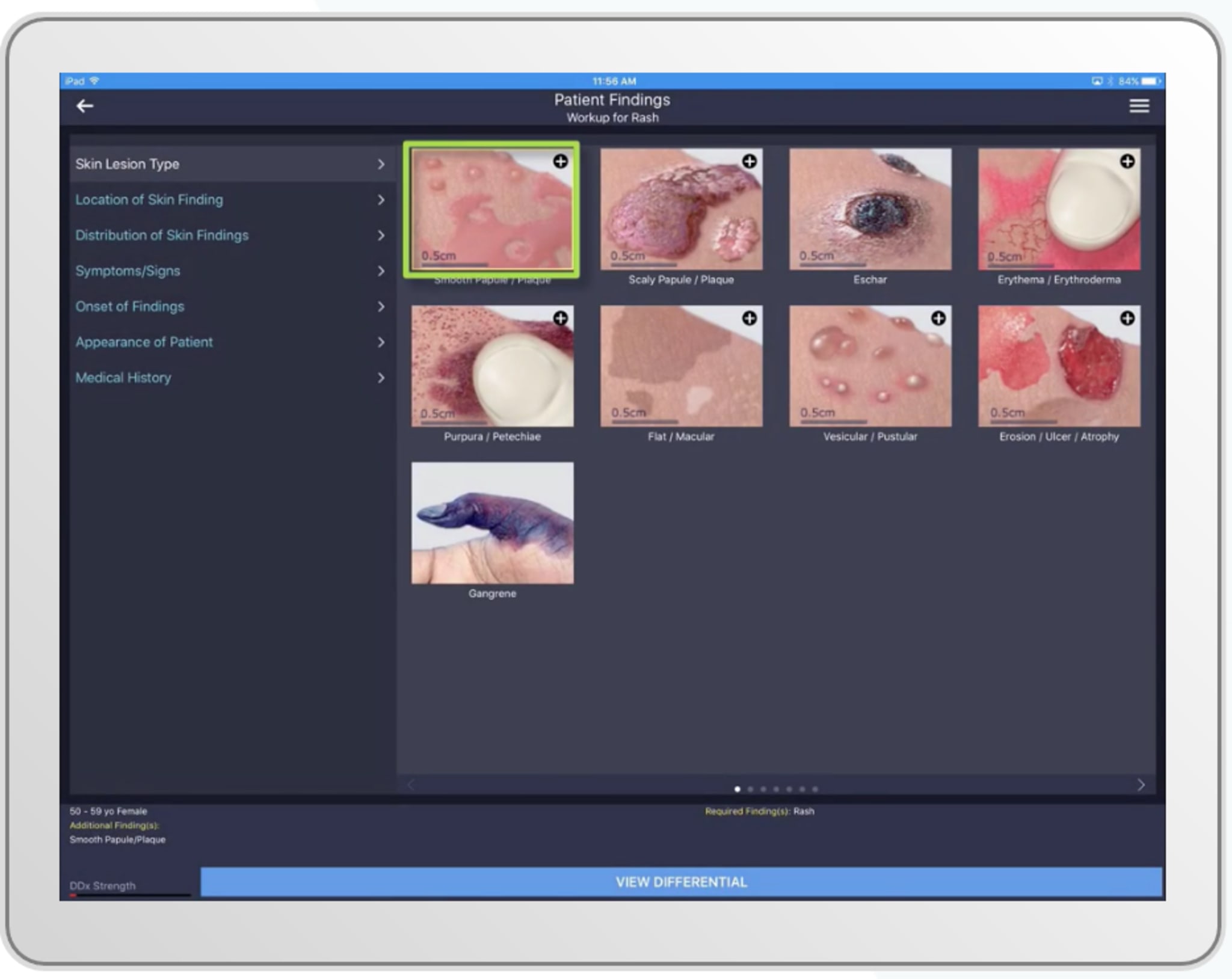 Diagnosetool VisualDx: Praktische Hilfe von Dermatologie bis Radiologie ...