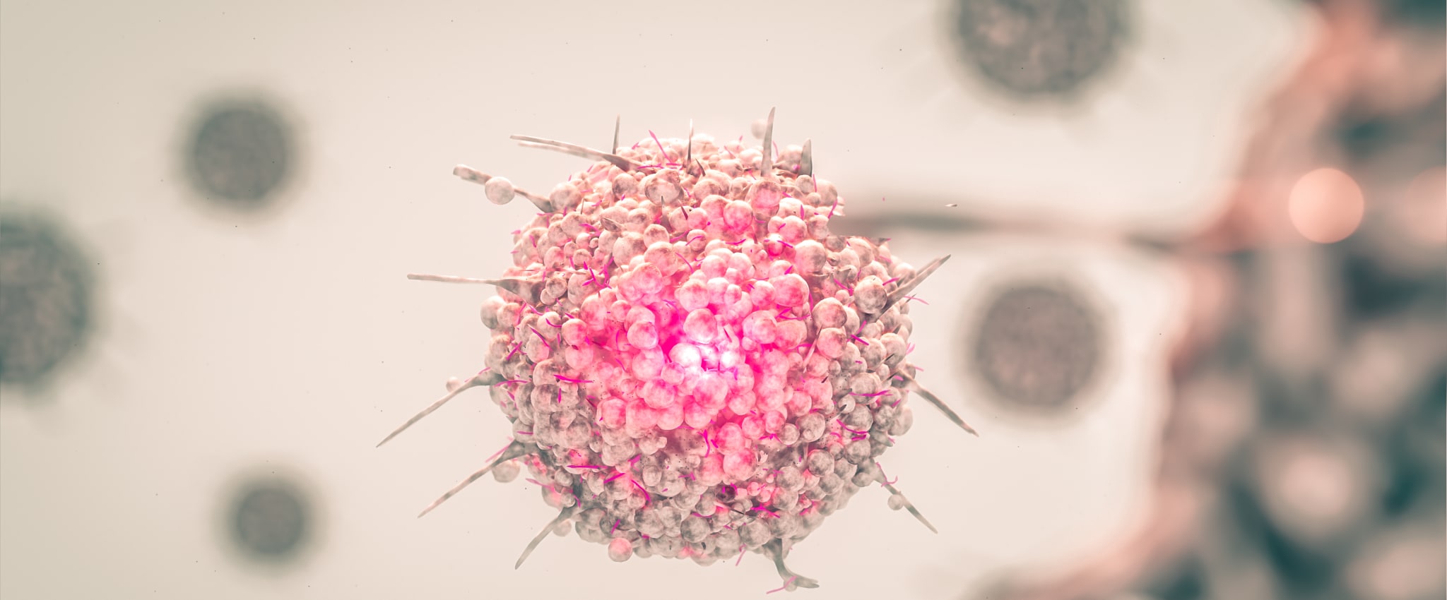 Update der S3-Leitlinie zum Prostatakarzinom - coliquio