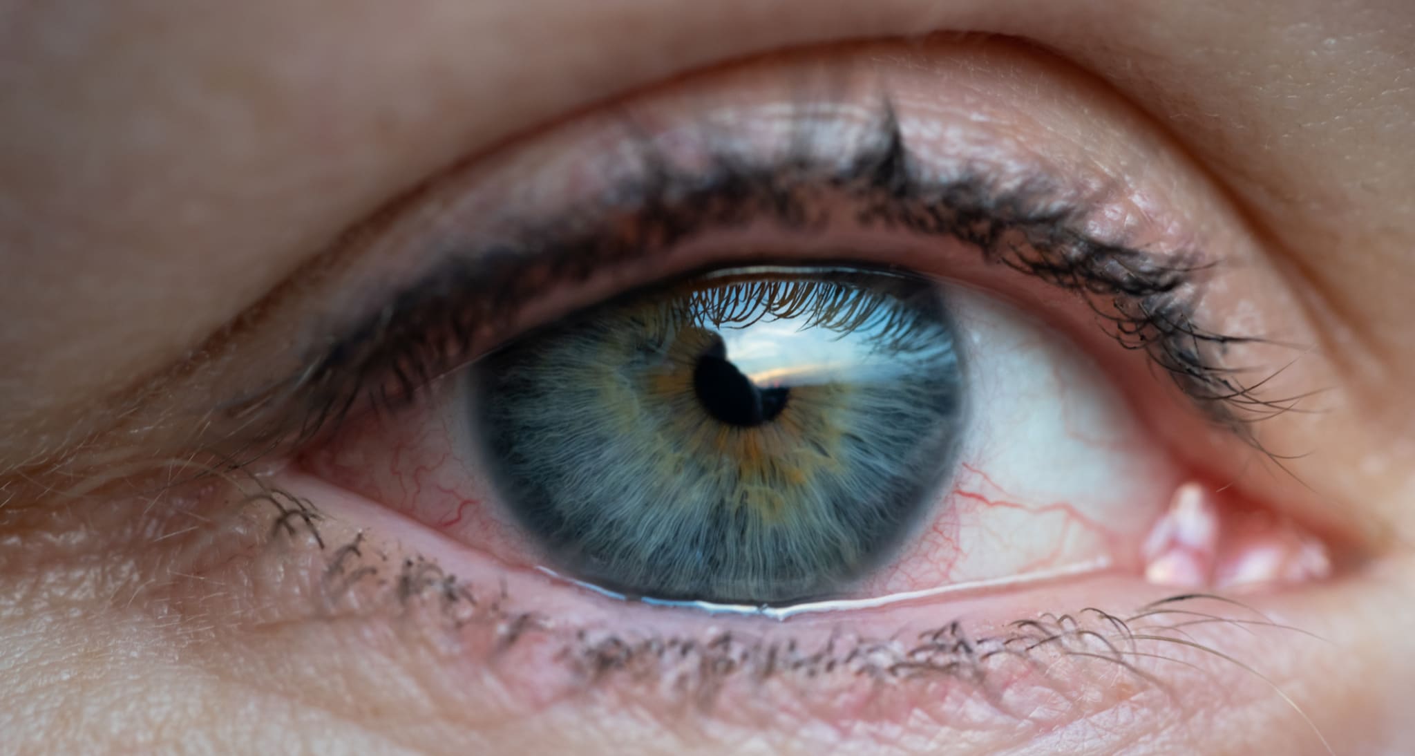 Grauer Star: Beide Augen in gleicher OP oder verzögert? - coliquio